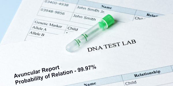 Fake Avuncular (Aunt/Uncle) Test - DNA Testing – Fake Paternity Test